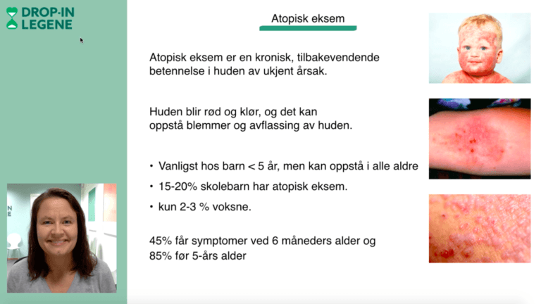 hud Arkiver - Drop-In legene